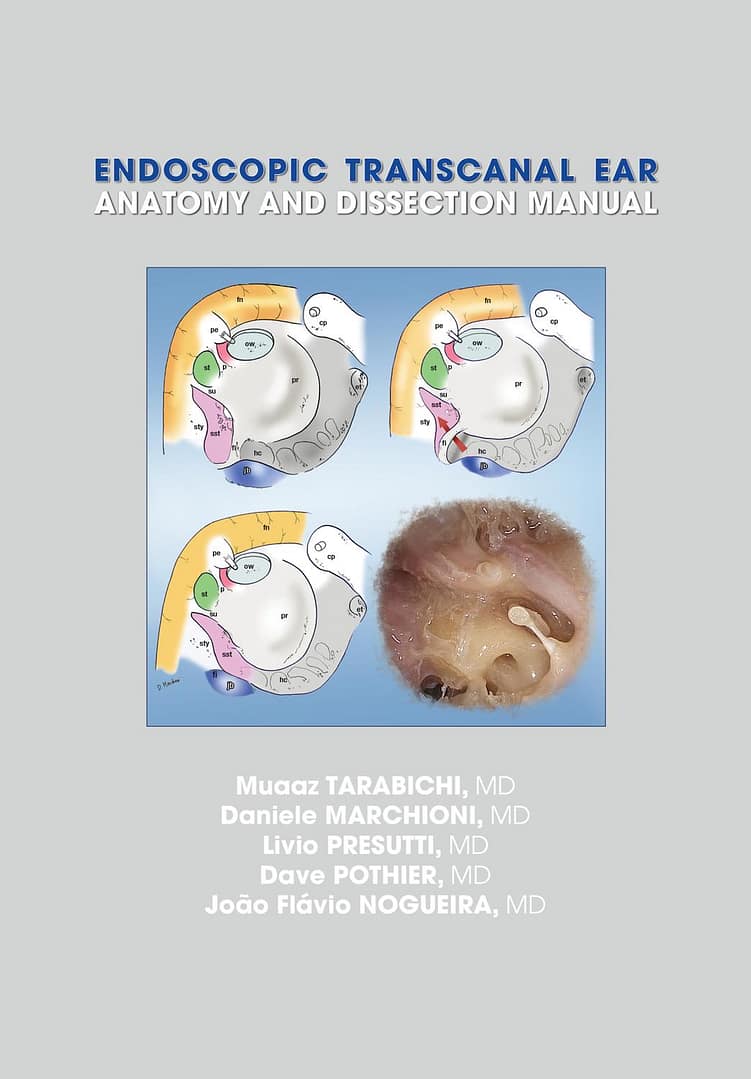 Books by Dr. Muaaz Tarabichi – Endoscopic Ear Surgery & ENT Surgery Guide